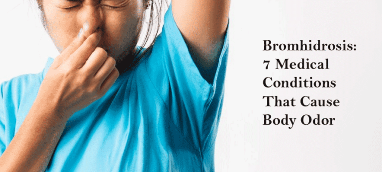 7 Medical Conditions That Cause Bad Body Odor – HealthcareOnTime