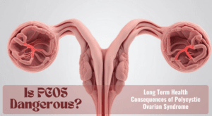 Is PCOS Dangerous? Explore the Consequences of Untreated PCOD ...
