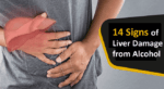 14 Signs of Liver Damage from Alcohol: Expert Tips for Early Detection ...