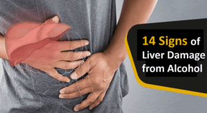 14 Signs of Liver Damage from Alcohol: Expert Tips for Early Detection ...