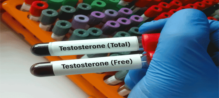 Testosterone Test: Testosterone Levels, Procedure & Result ...